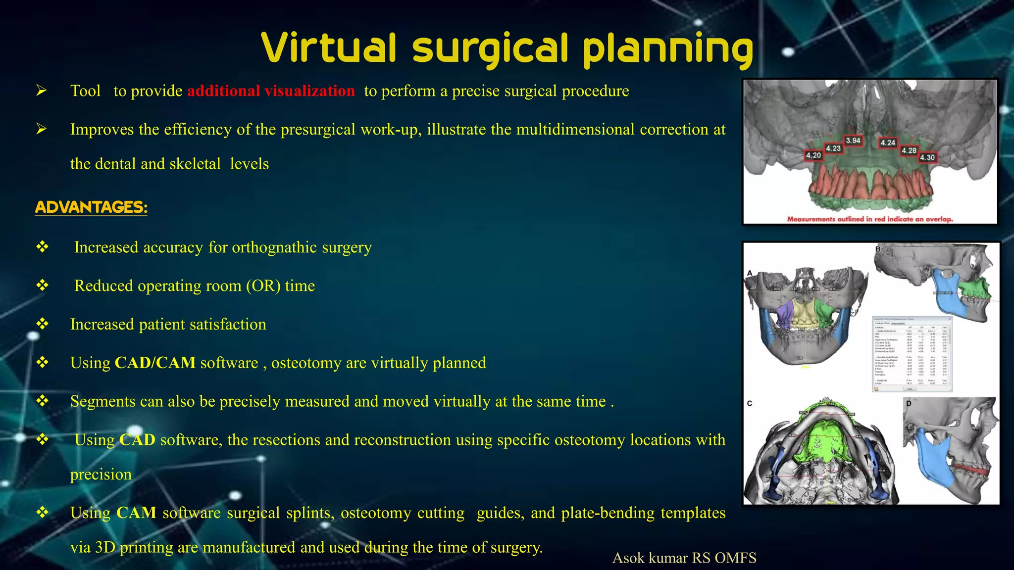 Diagnosis and treatment planning in orthognathic surgery | PDF