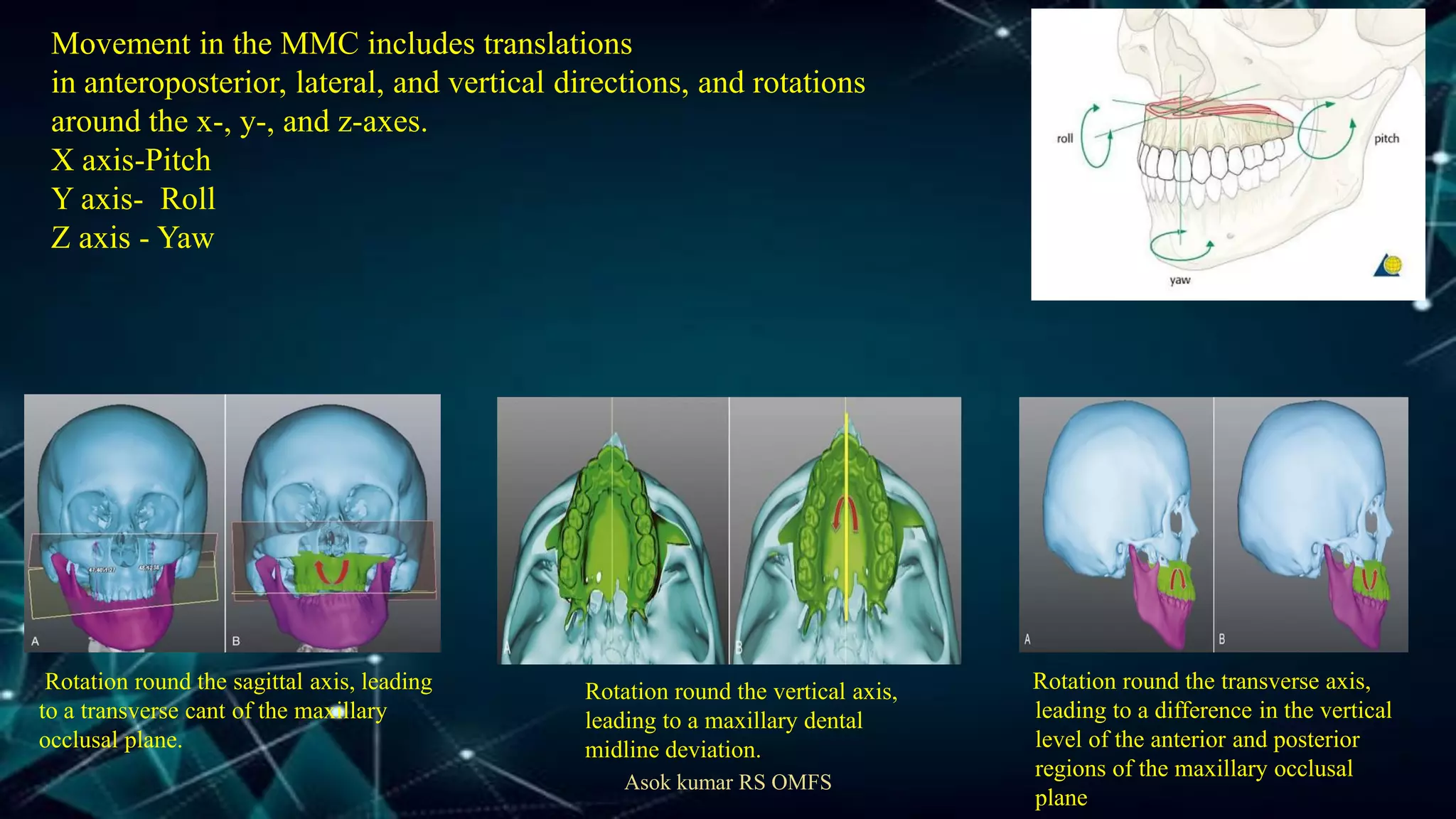 Diagnosis and treatment planning in orthognathic surgery | PDF
