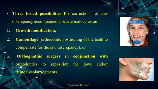 Diagnosis and treatment planning in orthognathic surgery | PDF
