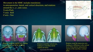 Diagnosis and treatment planning in orthognathic surgery | PDF