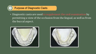 Diagnosis and Treatment Planning In Removable Partial Dentures.pptx