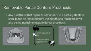 Diagnosis and Treatment Planning In Removable Partial Dentures.pptx