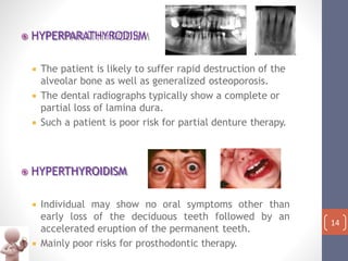 Diagnosis and treatment planning in rpd | PPTX