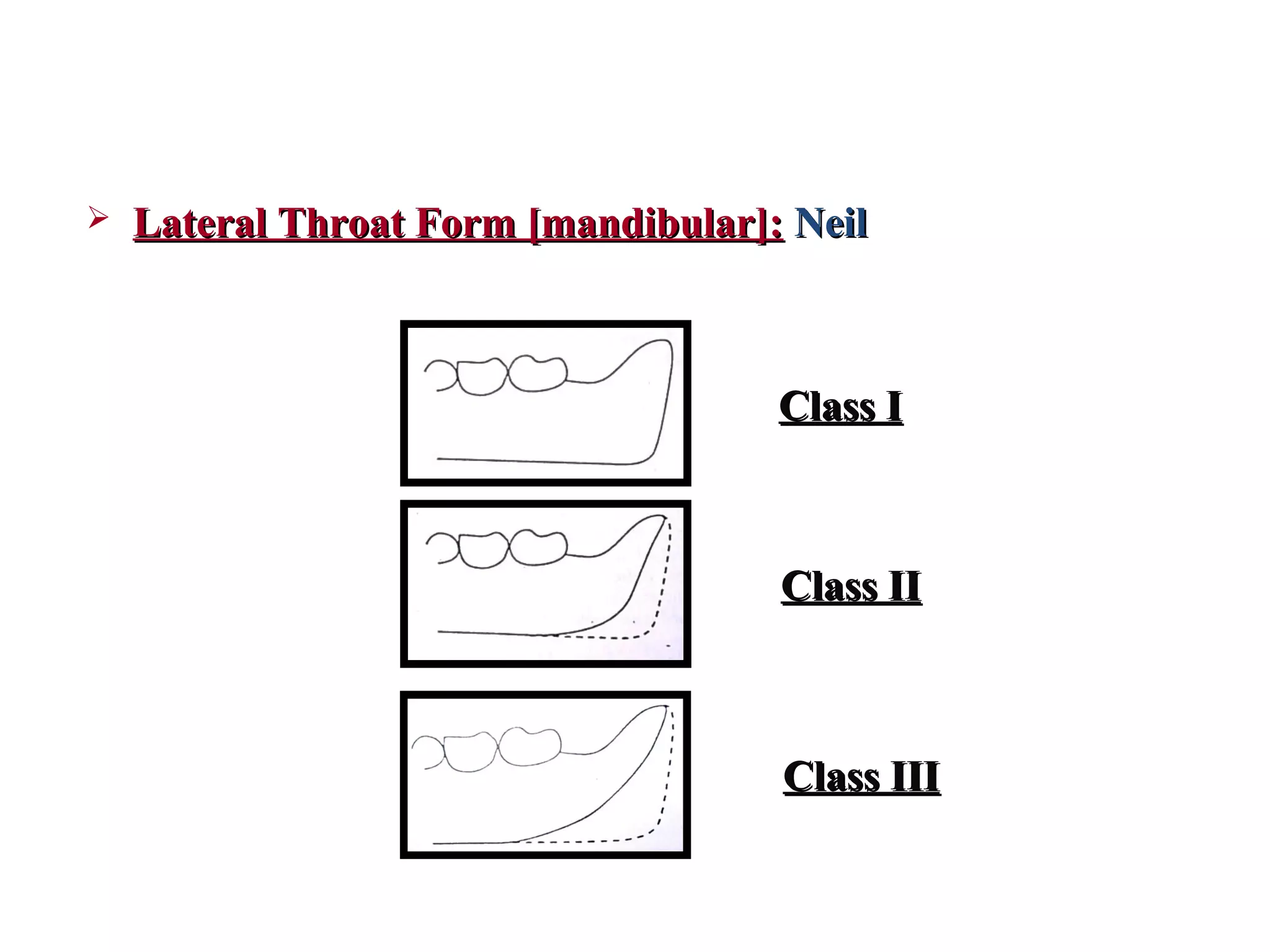 Diagnosis and treatment planning of edentulous patients | PPT