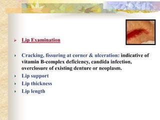 DIAGNOSIS AND TREATMENT PLANNING OF EDENTULOUS PATIENTS (2).ppt