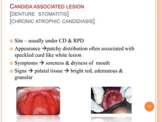 Diagnosis and treatment plan of complete denture | PPTX