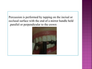 Diagnosis and treatment planing in Endodontics | PPT