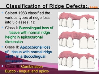 Diagnosis and tretment planning in fpd | PPT