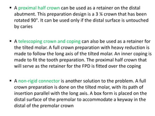 Diagnosis_and_tt_planning IN FIXED PARTIAL | PPT