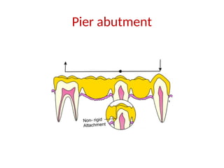 Diagnosis_and_tt_planning_in_FDP_II .ppt