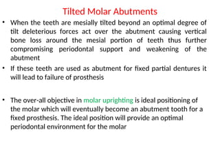 Diagnosis_and_tt_planning_in_FDP_II .ppt