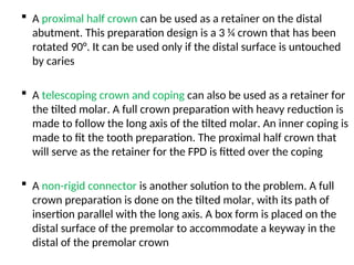 Diagnosis_and_tt_planning_in_FDP_II .ppt