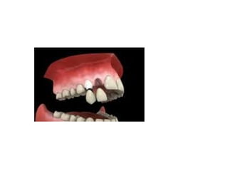 Diagnosis_and_tt_planning_in_FDP_II .ppt