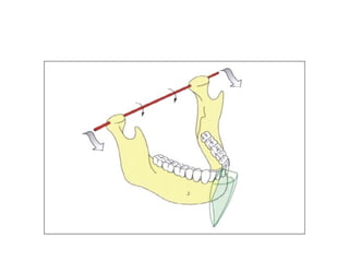 Diagnosis_and_tt_planning_in_FDP_II .ppt