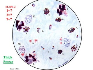 Diagnosis & blood stages of malaria . | PPTX