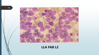 Diagnosis dan Penatalaksanaan Leukemia Akut dan Kronik pada.pptx