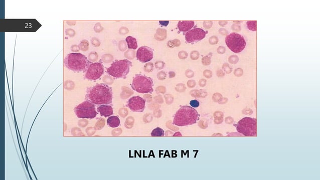 Diagnosis dan Penatalaksanaan Leukemia Akut dan Kronik pada.pptx