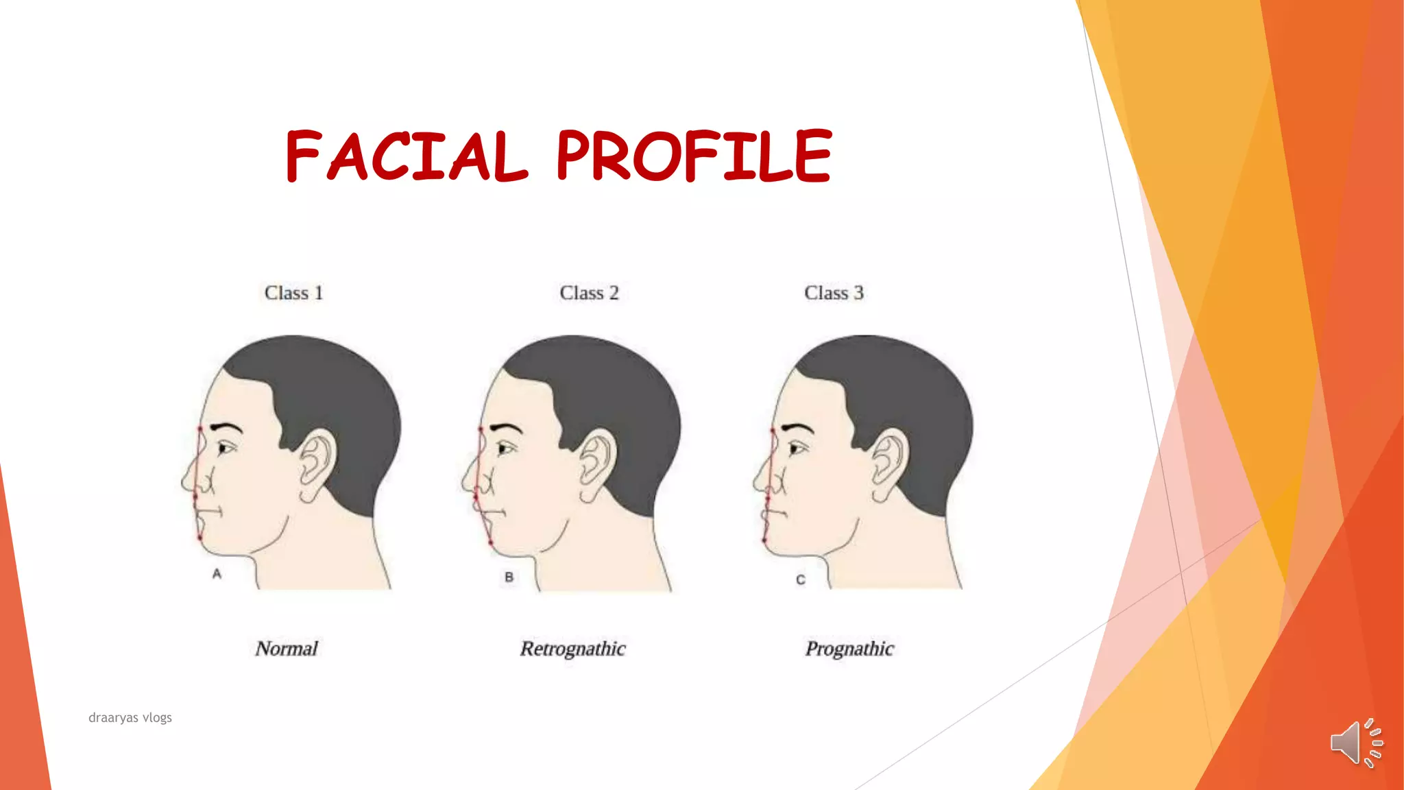 Diagnosis and treatment planning in completely edentulous patients | PPTX
