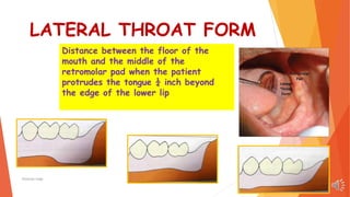 Diagnosis and treatment planning in completely edentulous patients | PPTX