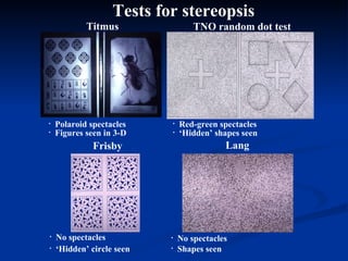 Diagnosis evaluation in strabismus | PPT
