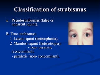 Diagnosis evaluation in strabismus | PPT