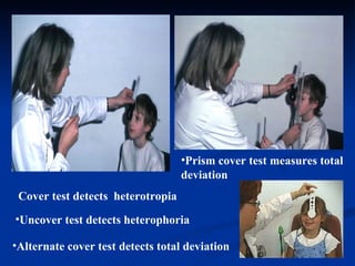 Diagnosis evaluation in strabismus | PPT