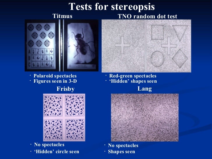 Diagnosis evaluation in strabismus