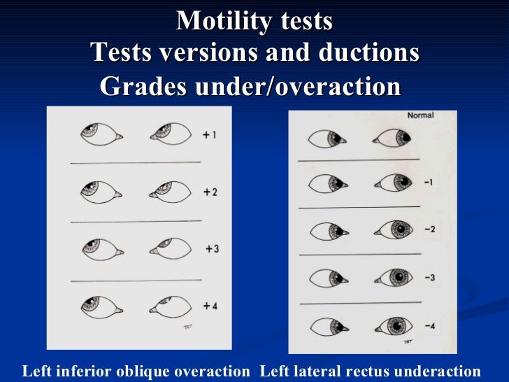 Diagnosis evaluation in strabismus