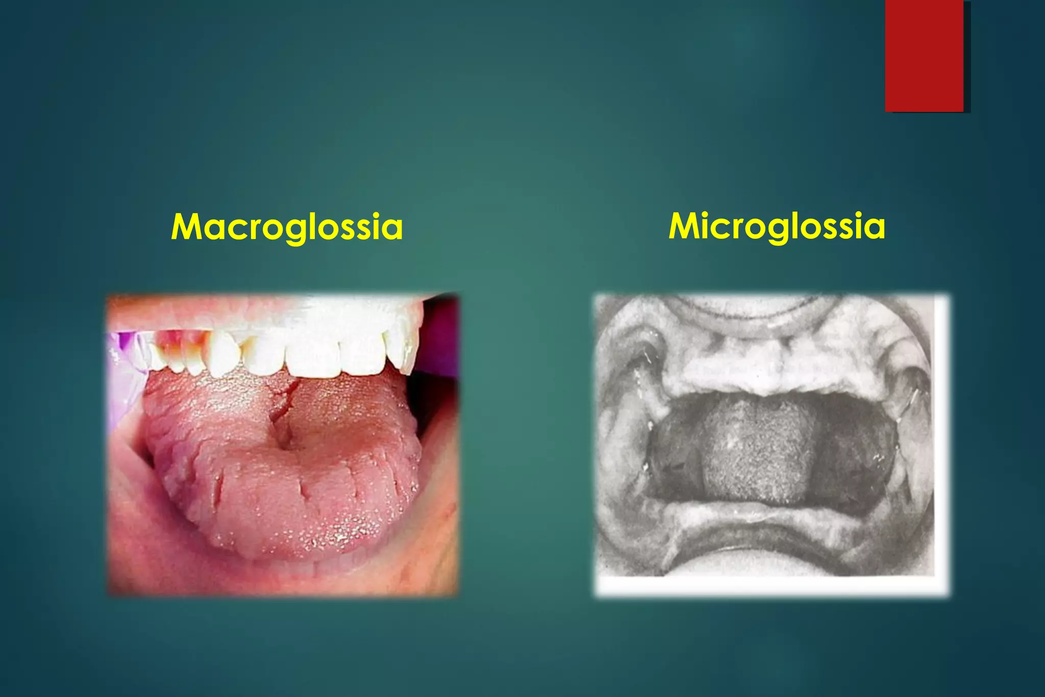 Diagnosis for edentulous patients | PPT