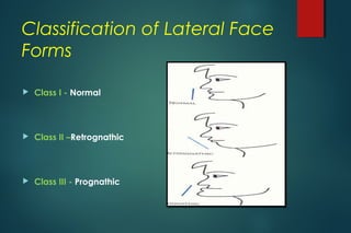 Diagnosis for edentulous patients | PPT