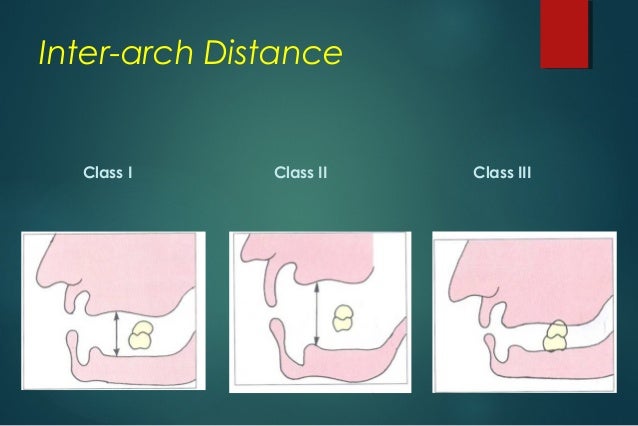 Diagnosis for edentulous patients