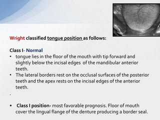 Diagnosis in complete denture | PPTX