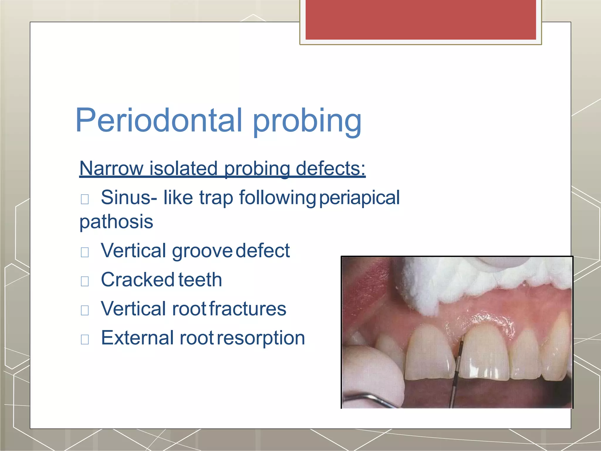 DIAGNOSIS IN ENDODONTICS .pptx