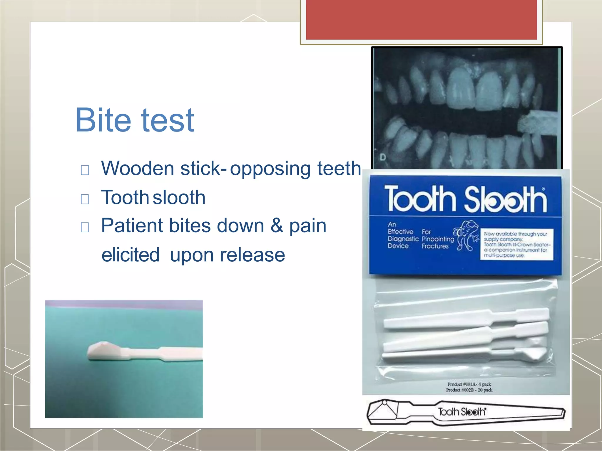 DIAGNOSIS IN ENDODONTICS .pptx