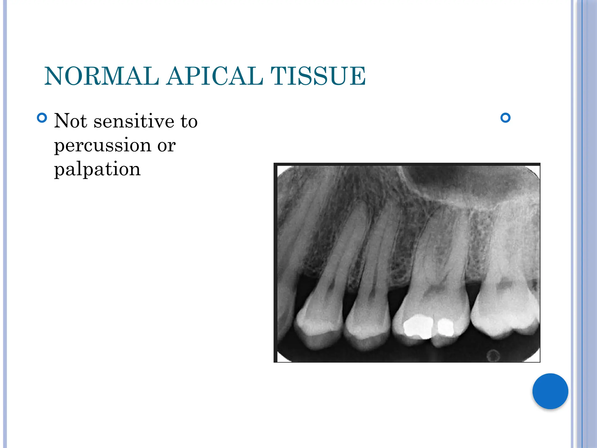 Making Diagnosis in Endodontics .566pptx | PPT