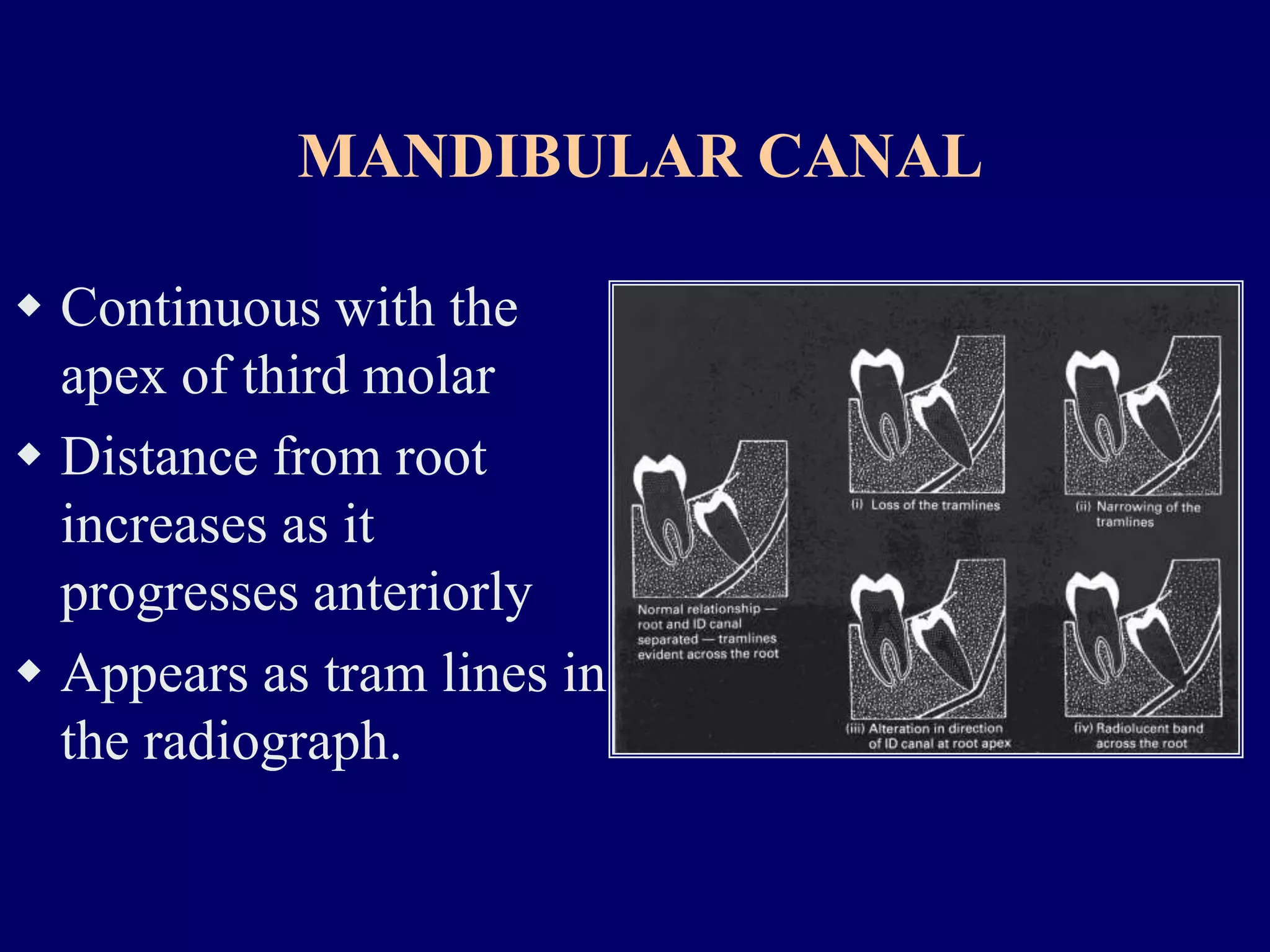 DIAGNOSIS IN ENDODONTICS | PPT