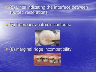 Diagnosis in operative dentistry | PPSX