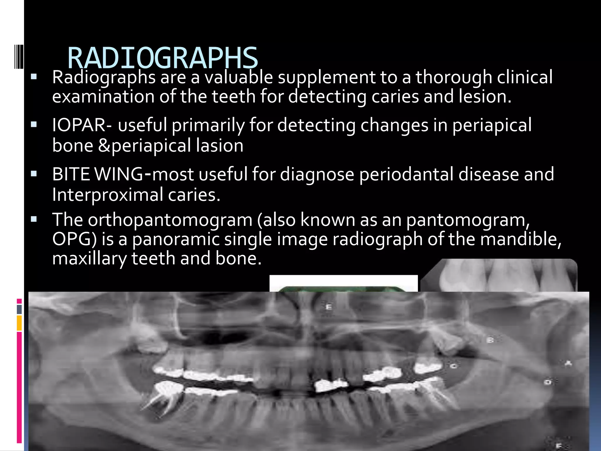 Diagnosis in operative dentistry | PPT