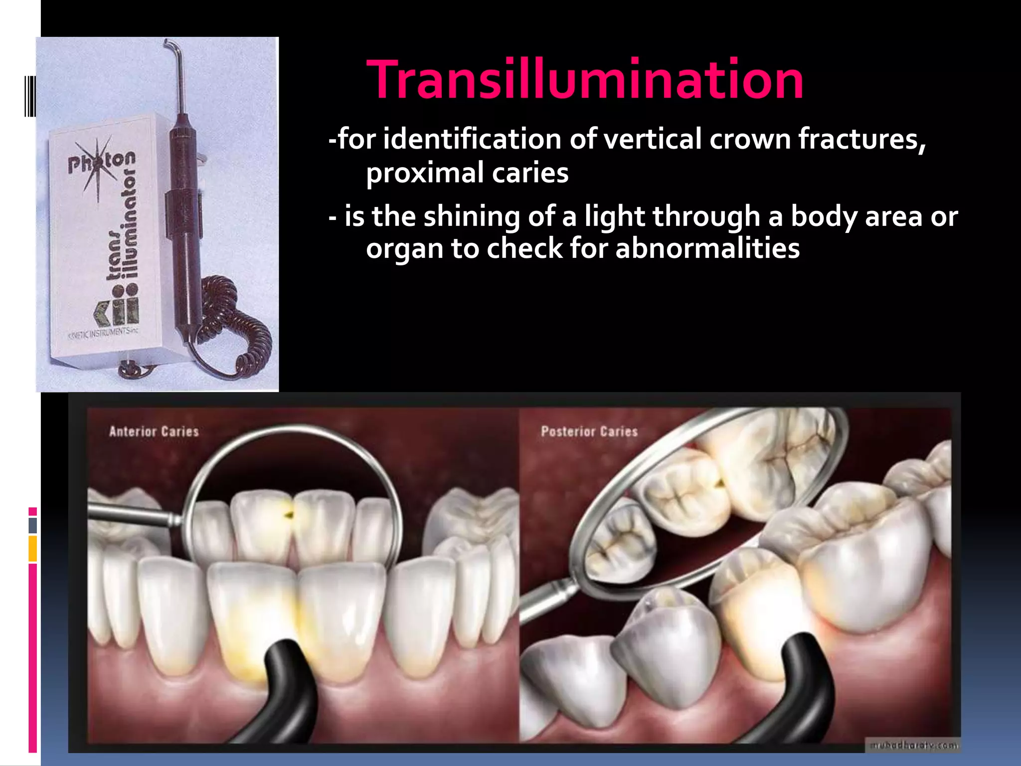 Diagnosis in operative dentistry | PPT