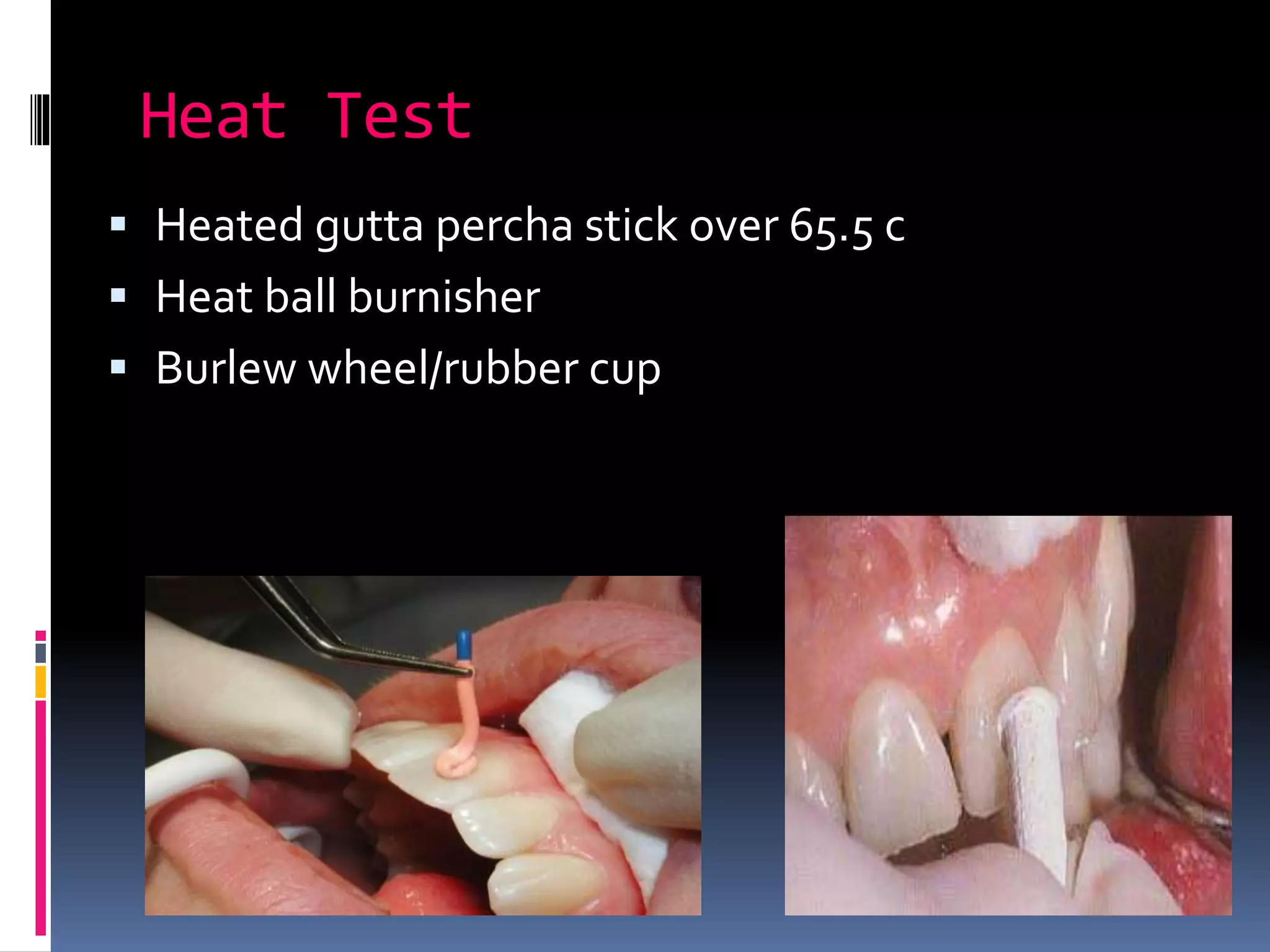 Diagnosis in operative dentistry | PPT