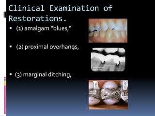 Diagnosis in operative dentistry | PPT