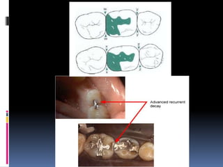 Diagnosis in operative dentistry | PPT