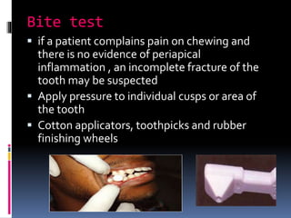 Diagnosis in operative dentistry | PPT