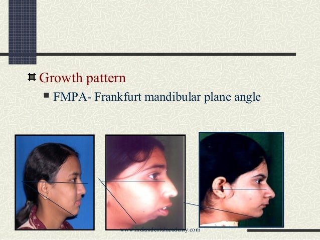 Diagnosis in orthodontics /certified fixed orthodontic courses by In…