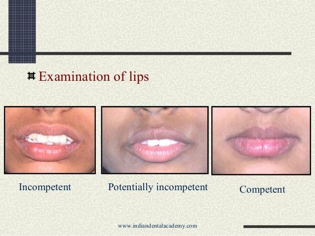 Diagnosis in orthodontics /certified fixed orthodontic courses by In…