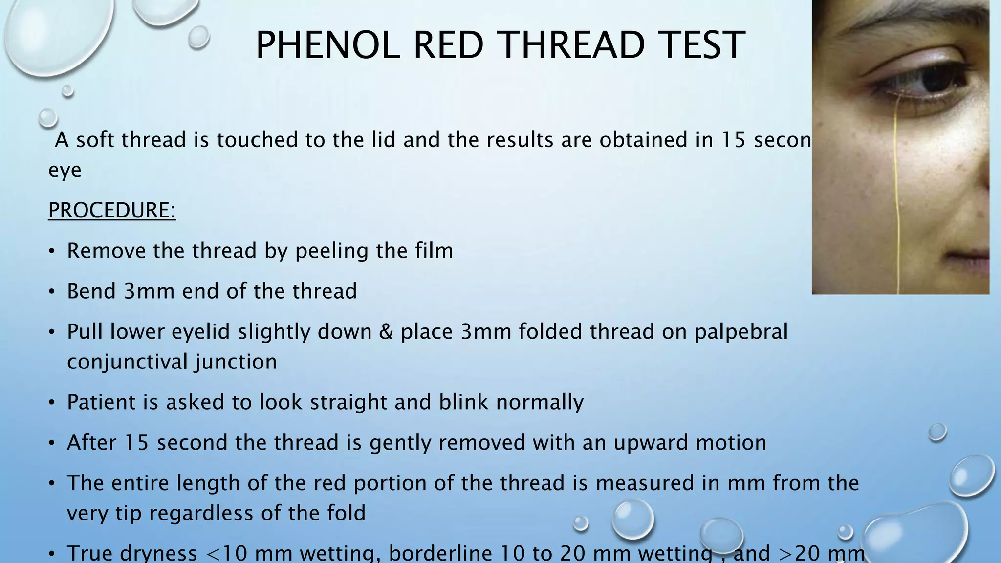 Diagnosis & management of dry eye | PPTX