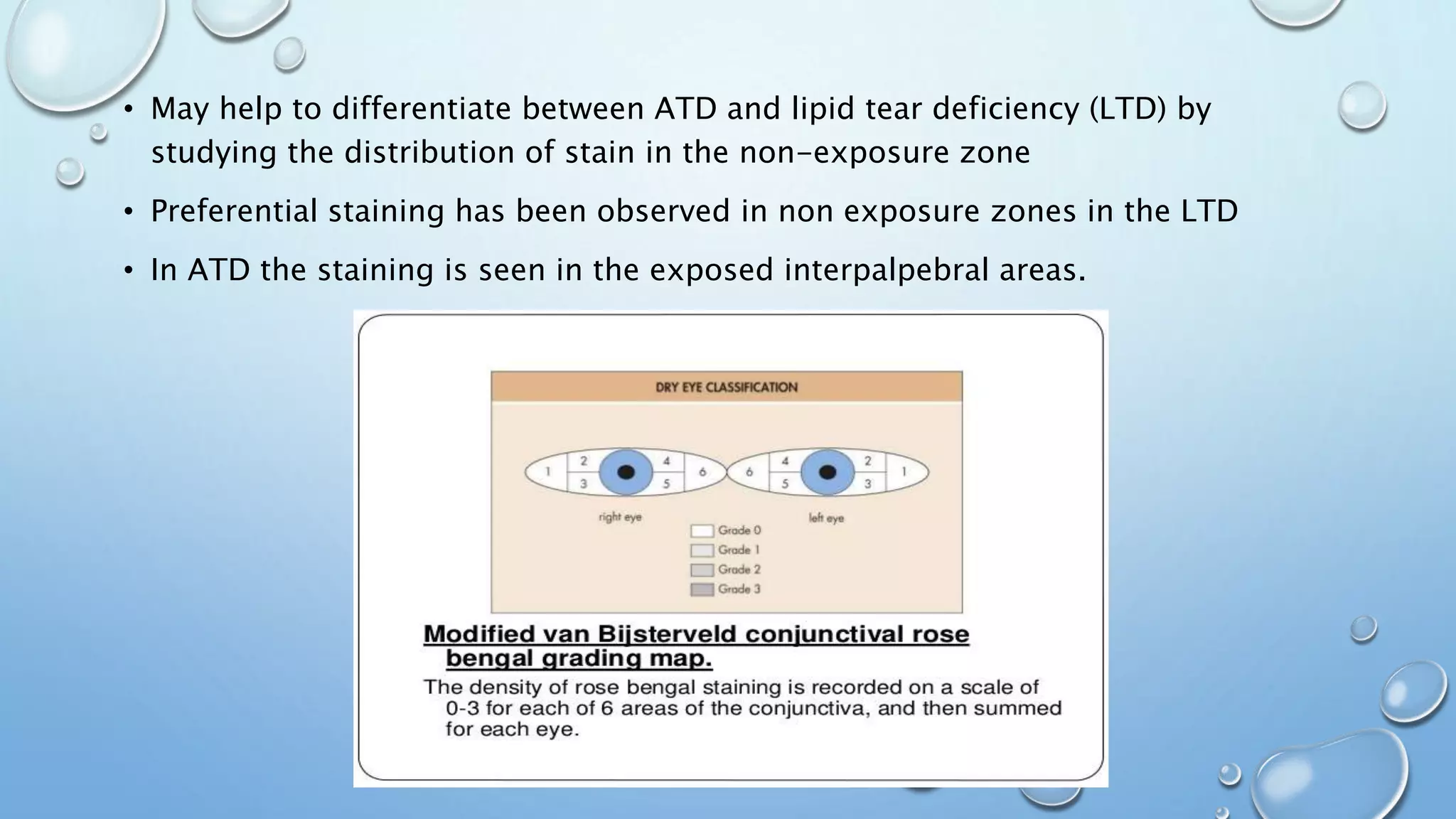 Diagnosis & management of dry eye | PPTX