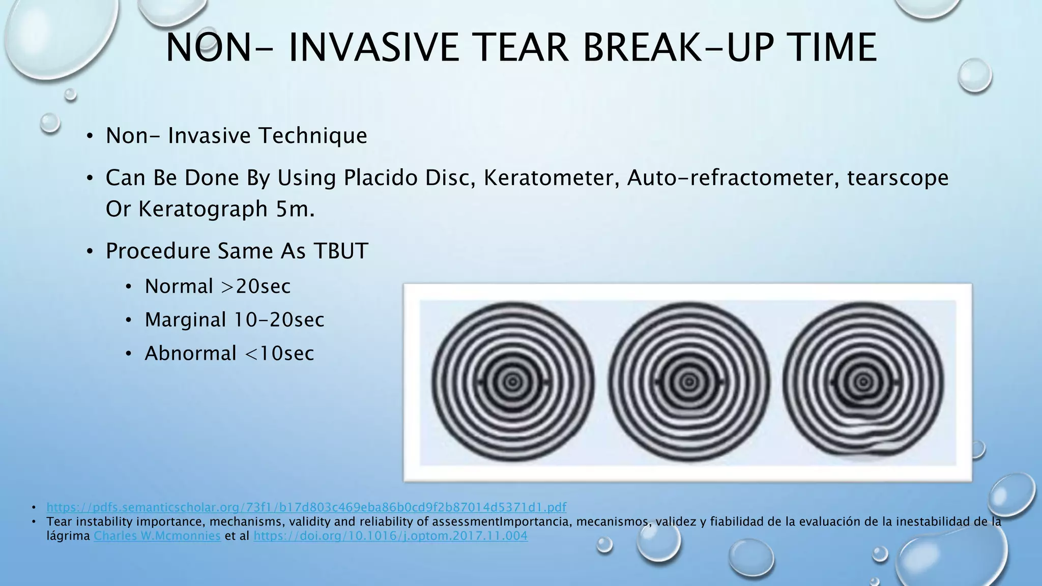Diagnosis & management of dry eye | PPTX