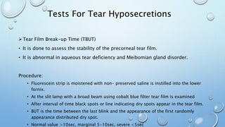 Diagnosis & management of dry eye | PPTX