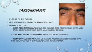 Diagnosis & management of dry eye | PPT